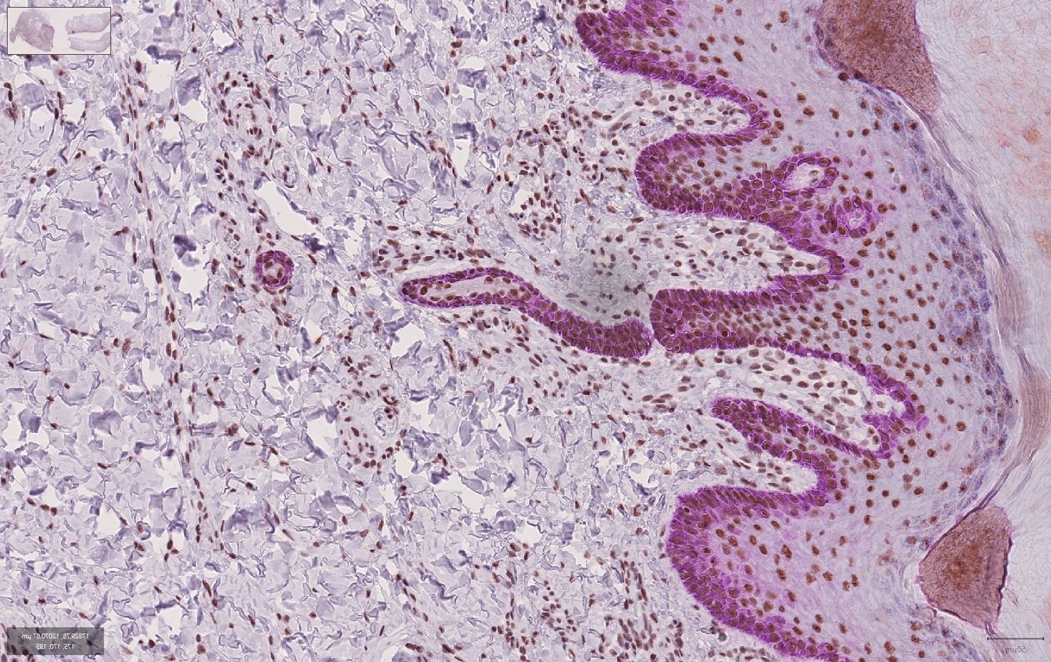 Research Programmes – CRUK – City Of London Cancer Centre