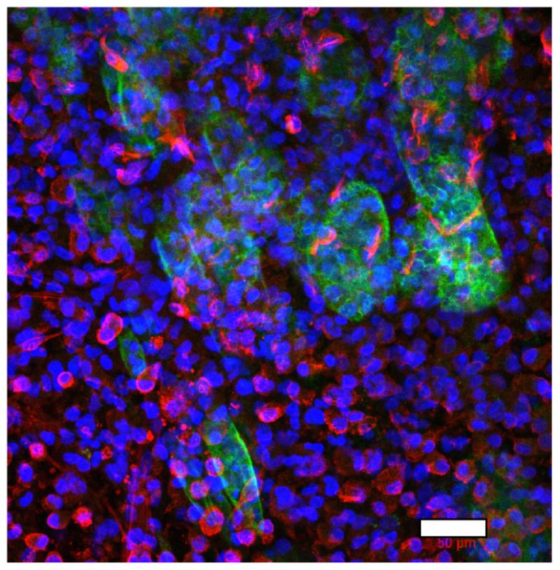 Human Tumour Microenvironment Models – CRUK – City Of London Cancer Centre