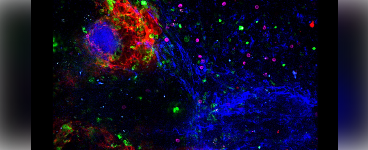 Events – CRUK – City Of London Cancer Centre