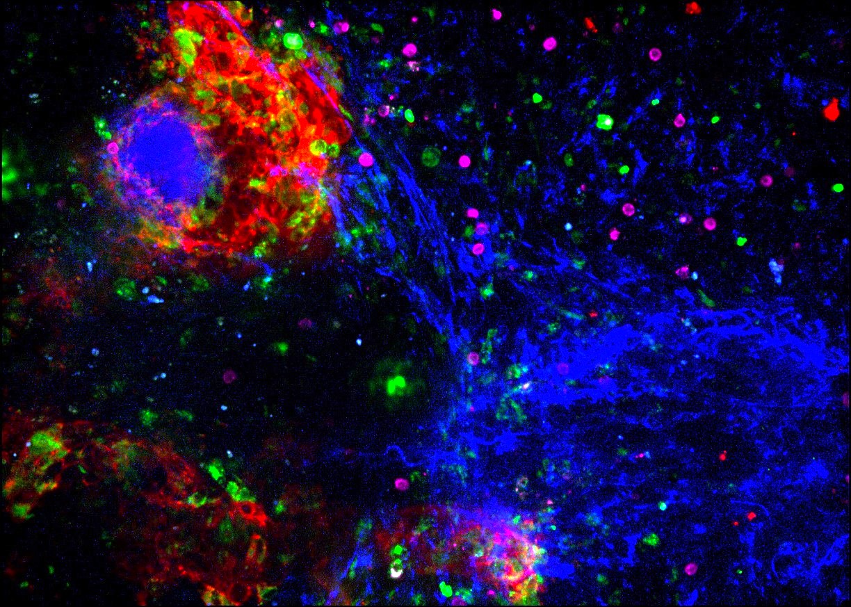 Winners image competition 2024 – CRUK – City Of London Cancer Centre