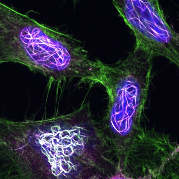 Winners image competition 2024 – CRUK – City Of London Cancer Centre