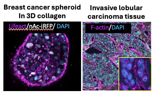 2026 BLiC PhD Project Parsons – CRUK – City Of London Cancer Centre